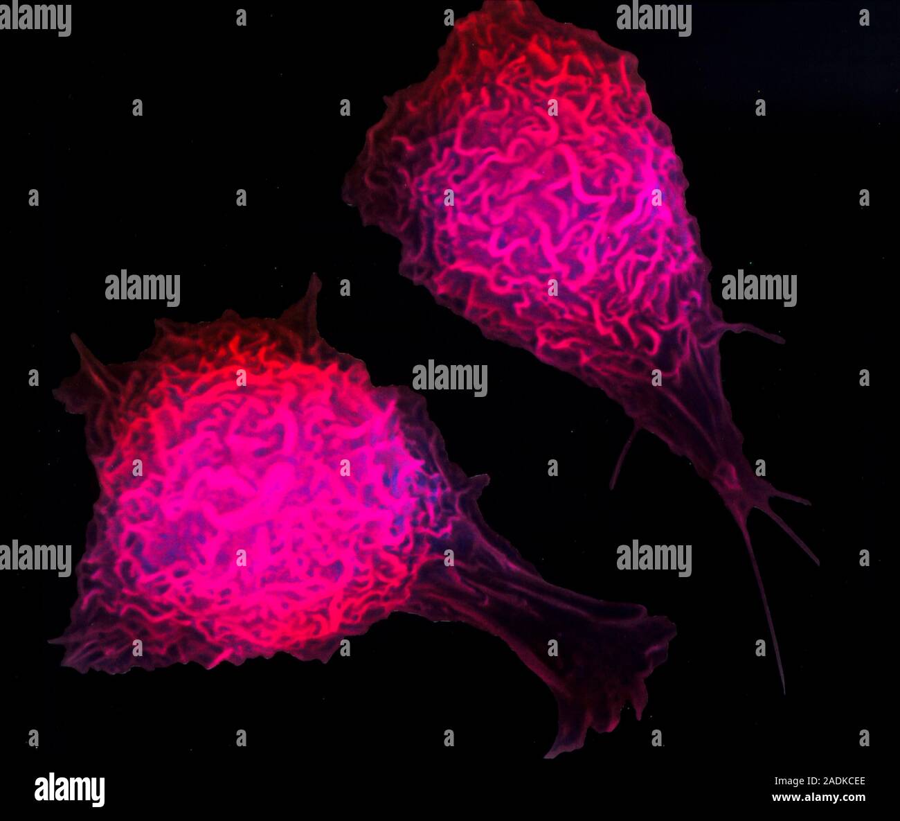 Macrophages. Coloured scanning electron micrograph (SEM) of active macrophage cells. In the ...