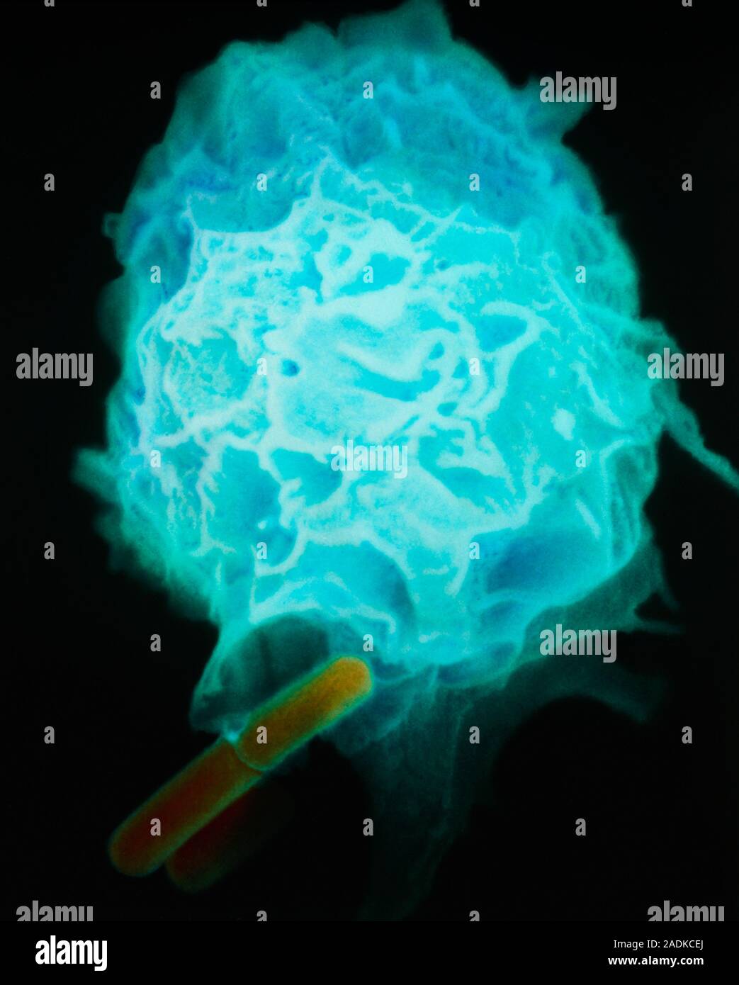 Macrophage attacks Clostridium bacteria. Coloured scanning electron ...