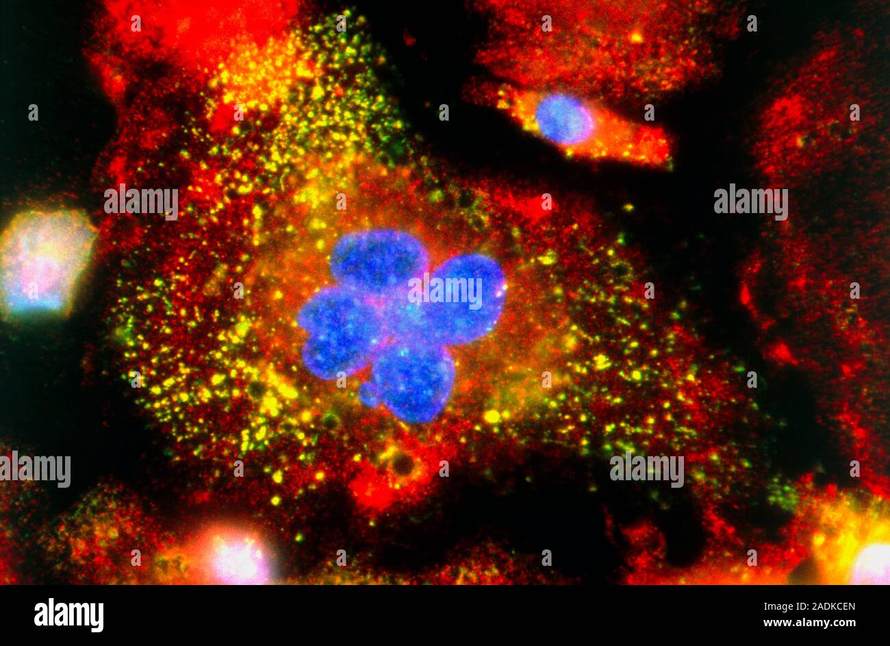 Active macrophages. Immunofluorescent light micrograph of active ...
