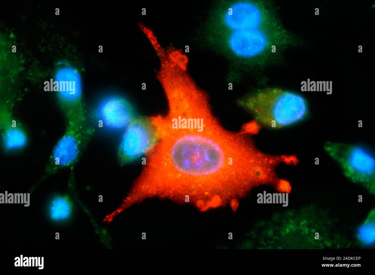Active macrophage. Immunofluorescent light micrograph of an active ...