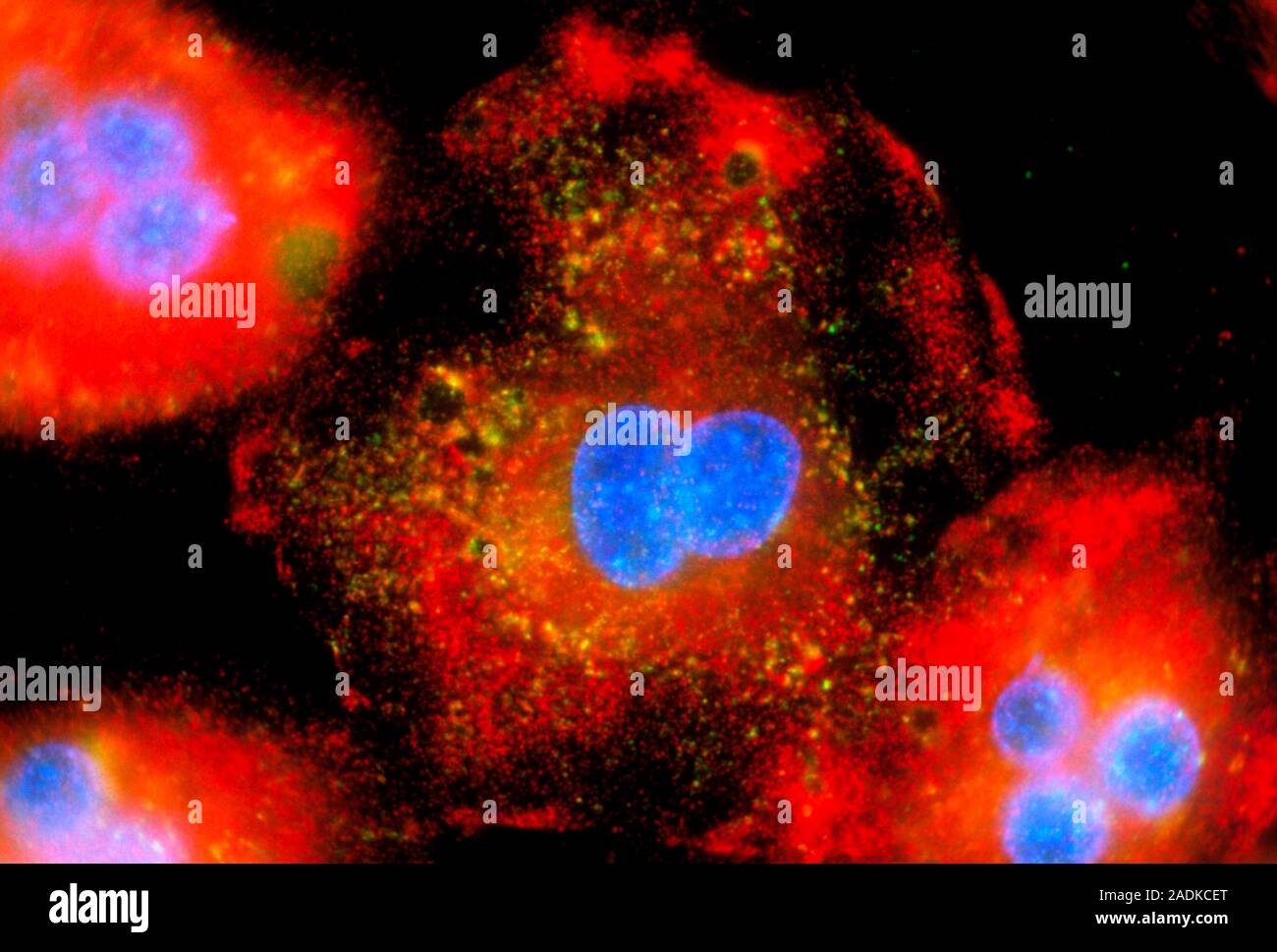Active macrophages. Immunofluorescent light micrograph of active ...