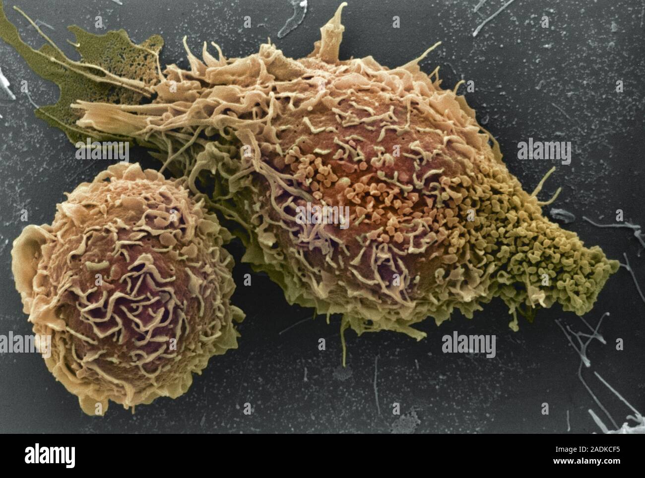 Macrophages. Coloured scanning electron micrograph (SEM) of macrophages. These white blood cells ...