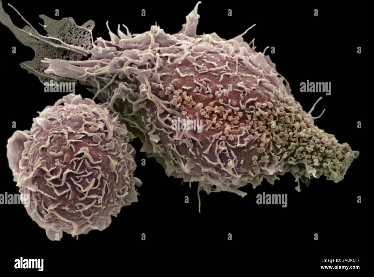 Macrophages. Coloured scanning electron micrograph (SEM) of macrophages. These white blood cells ...