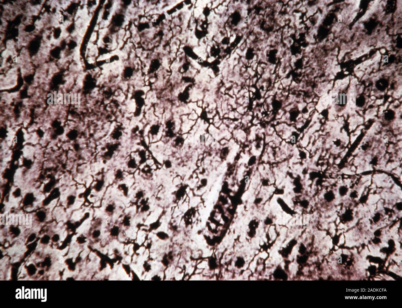 Microglia cells. Light micrograph of a section through microglia cells ...