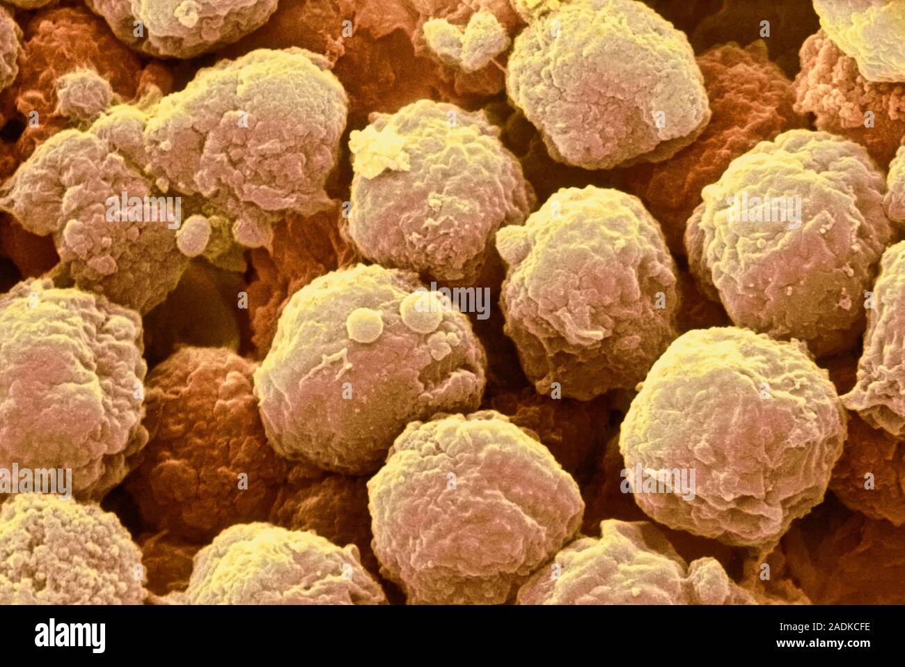Neutrophils. Coloured scanning electron micrograph (SEM) of neutrophils ...
