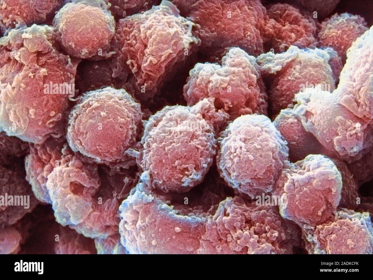 Monocytes. Coloured scanning electron micrograph (SEM) of monocyte ...