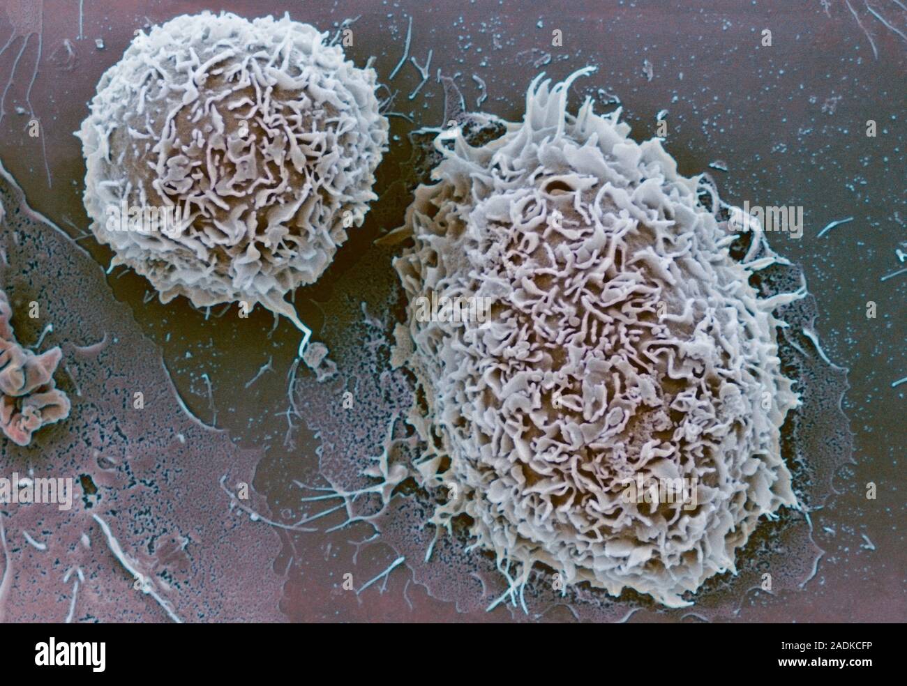 White blood cells. Coloured scanning electron micrograph (SEM) of macrophage white blood cells ...