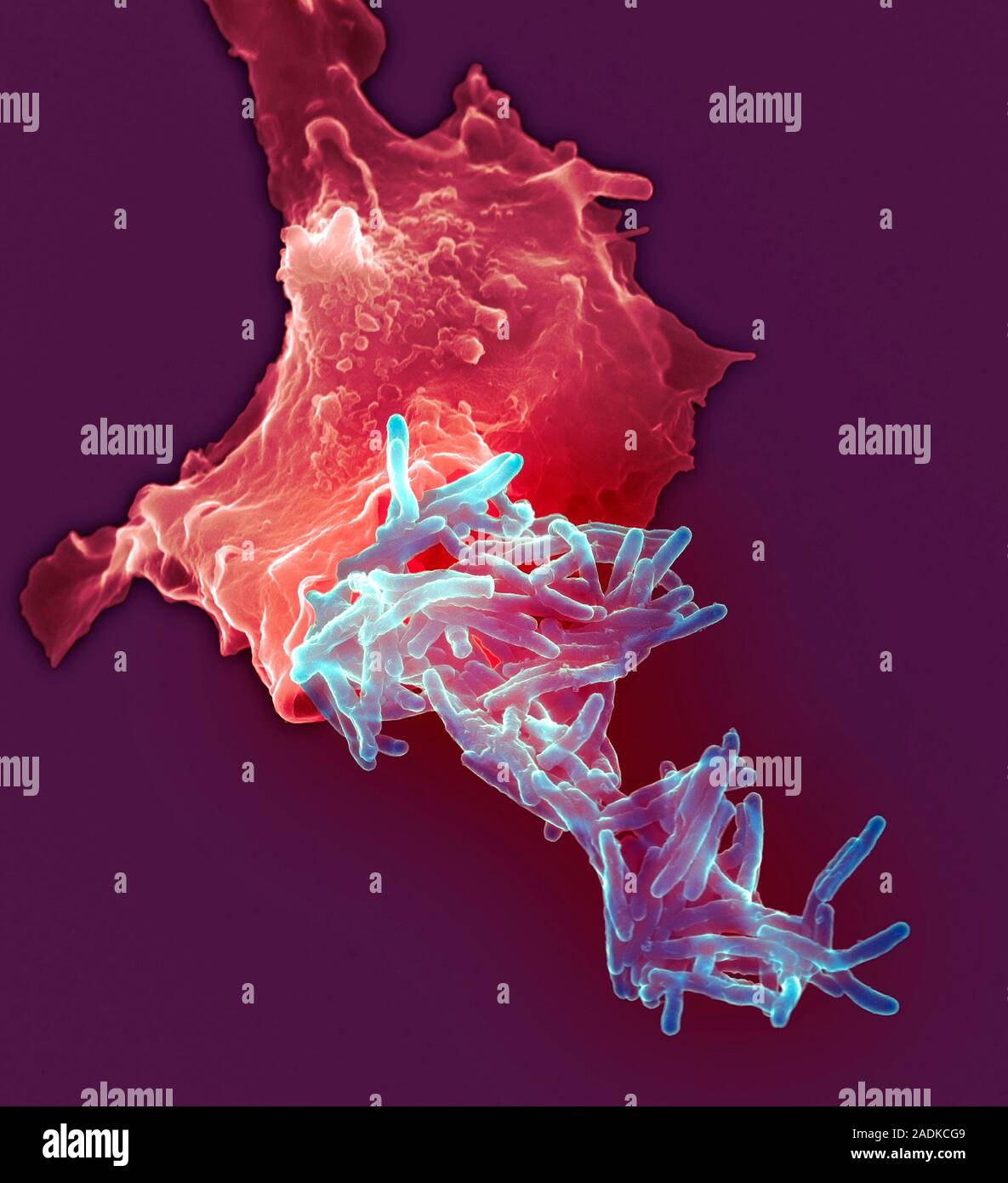 Macrophage engulfing tuberculosis vaccine. Coloured scanning electron micrograph (SEM) of a ...