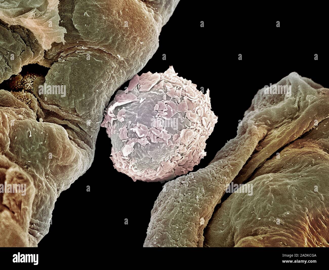 Macrophage in lung. Coloured scanning electron micrograph (SEM) of a ...