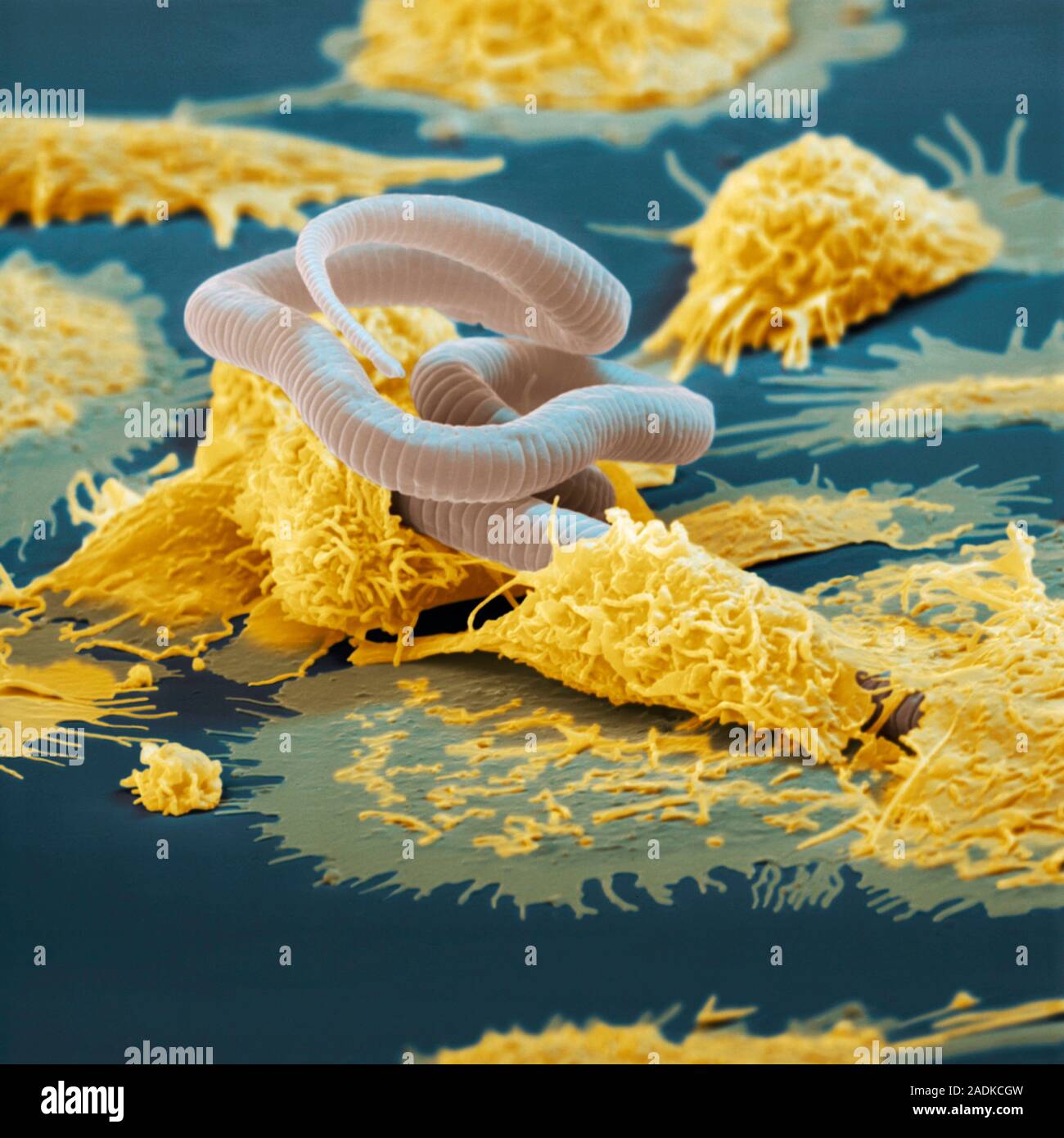Macrophages attacking parasitic larva. Coloured scanning electron ...