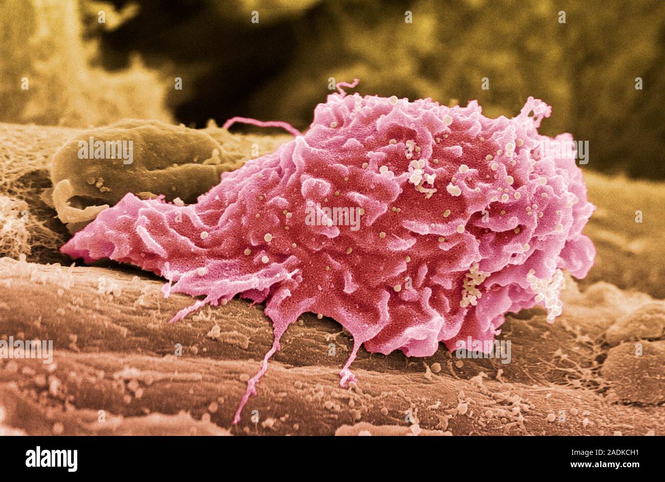 Macrophage. Coloured scanning electron micrograph (SEM) of a macrophage white blood cell at the ...