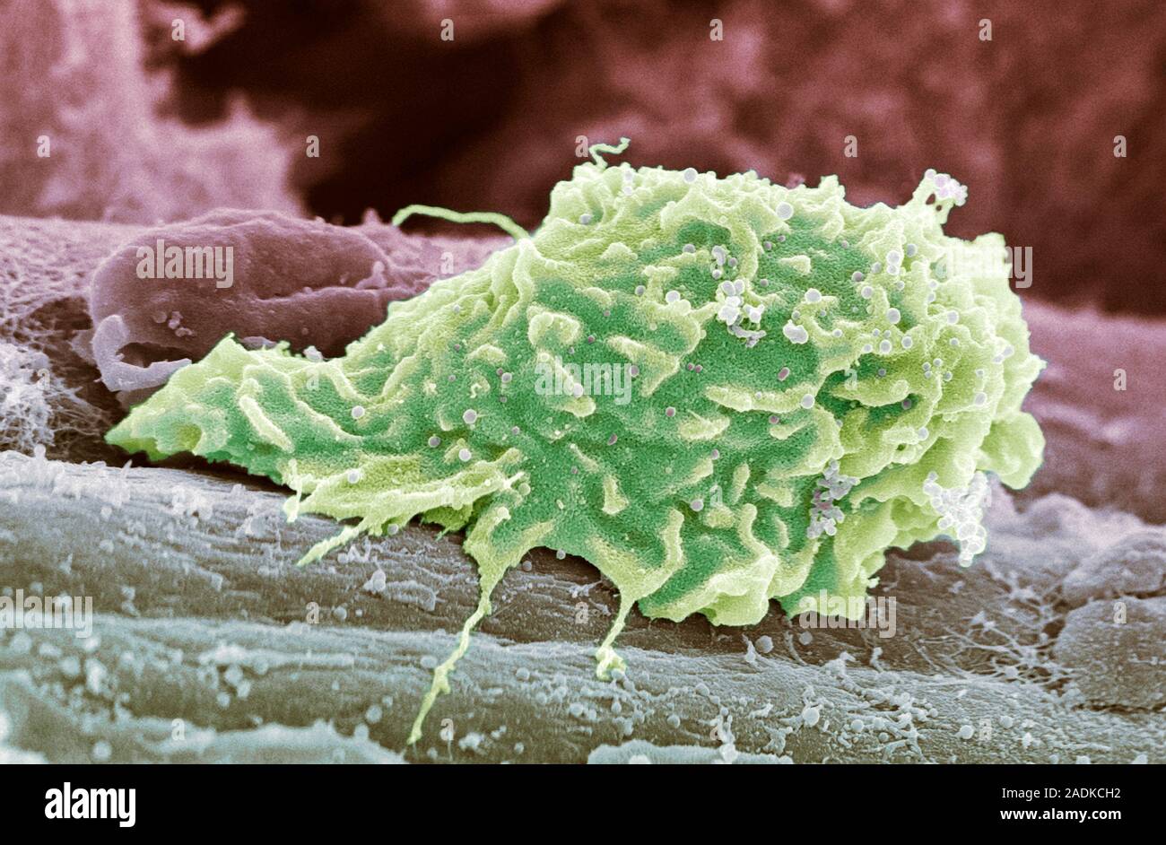 Macrophage. Coloured scanning electron micrograph (SEM) of a macrophage white blood cell at the ...