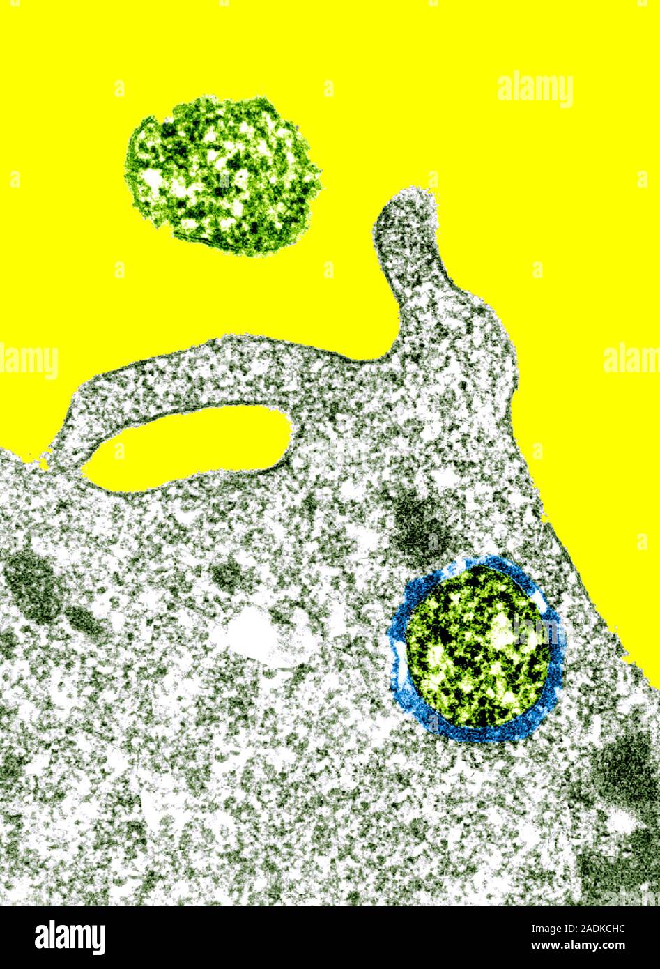 Macrophage attacking Mycoplasma bacteria. Coloured transmission ...