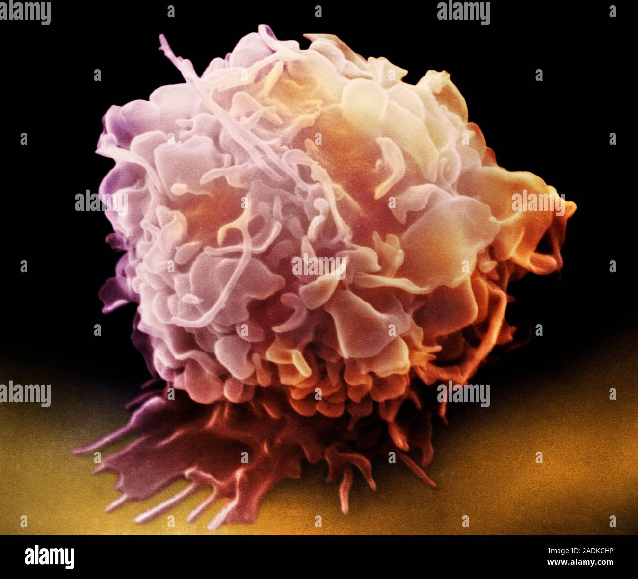 Macrophage. Coloured scanning electron micrograph (SEM) of a macrophage white blood cell ...