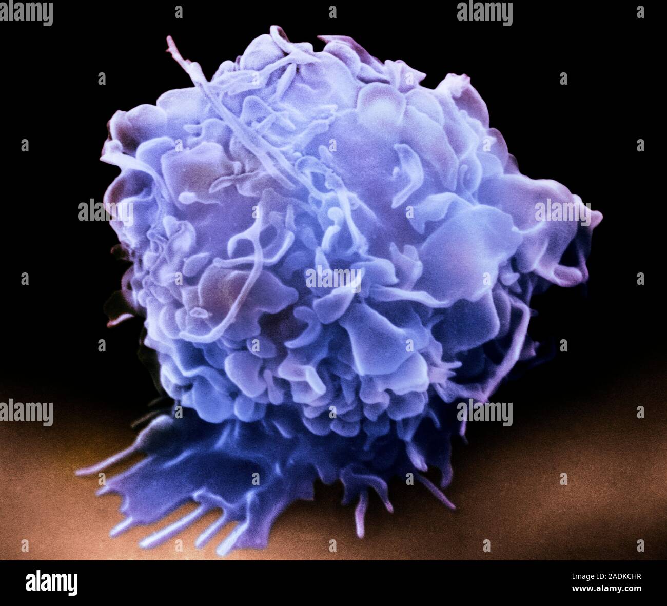 Macrophage. Coloured scanning electron micrograph (SEM) of a macrophage white blood cell ...
