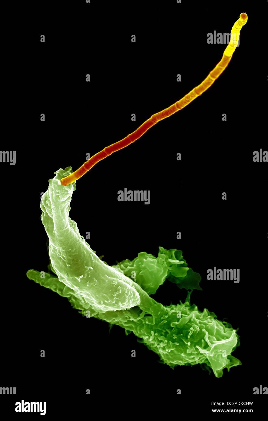 Neutrophils and anthrax bacteria. Coloured scanning electron micrograph ... Neutrophils and anthrax bacteria. Coloured scanning electron micrograph ...