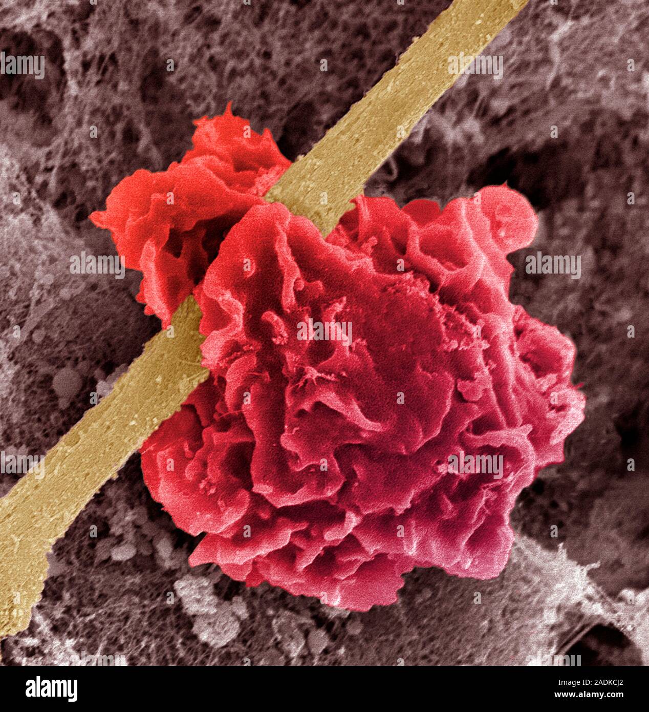 Macrophage ingesting cell debris at the site of a wound, coloured ...
