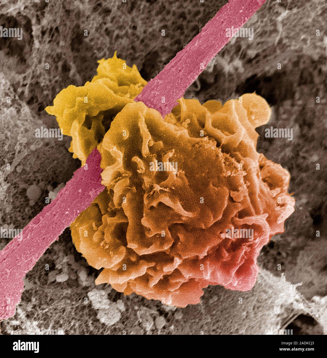 Macrophage ingesting cell debris at the site of a wound, coloured ...