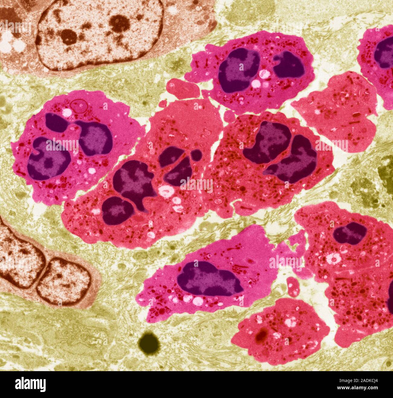 Neutrophil white blood cells. Coloured transmission electron micrograph ...