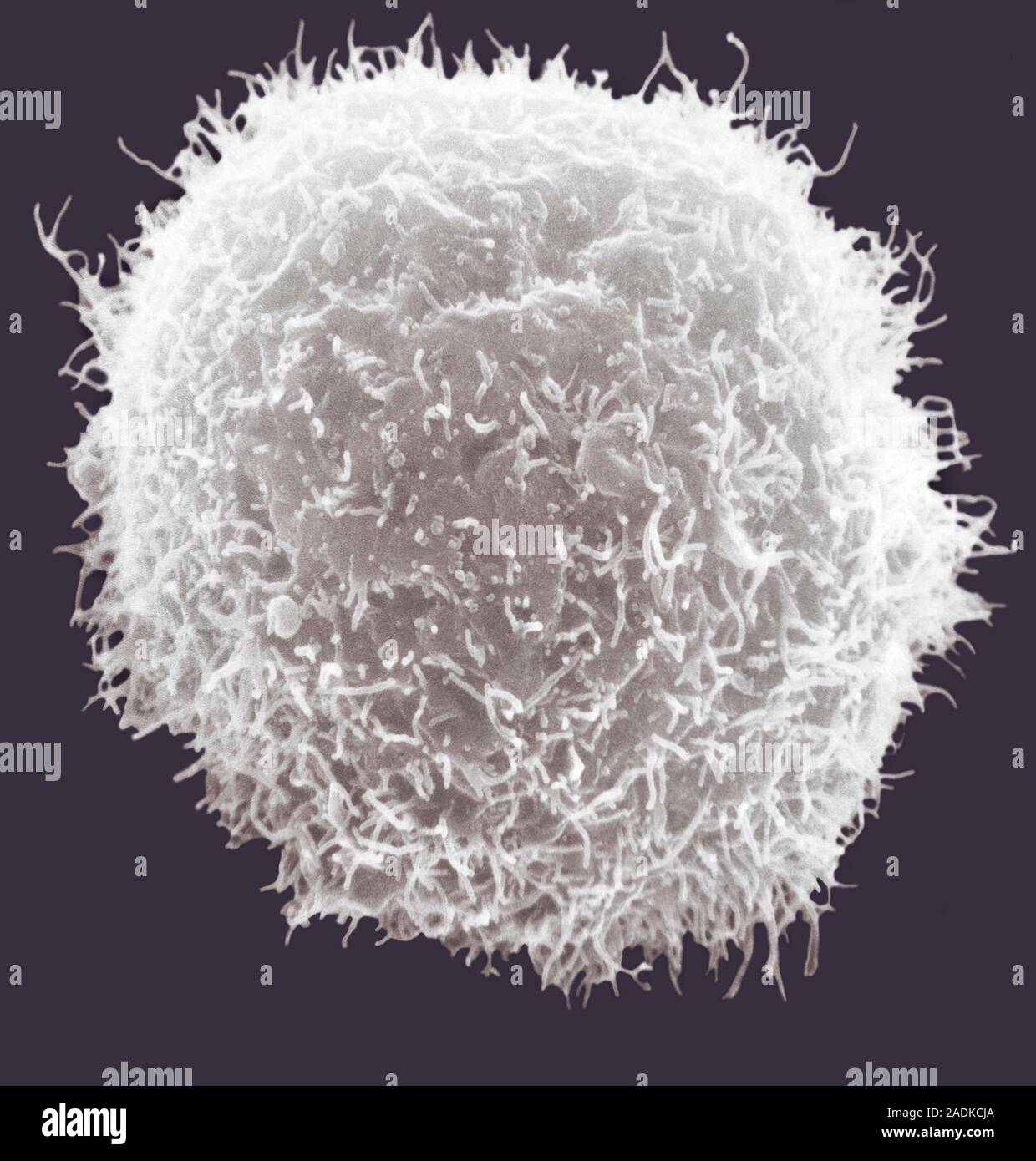 Macrophage. Coloured scanning electron micrograph (SEM) of a type of ...