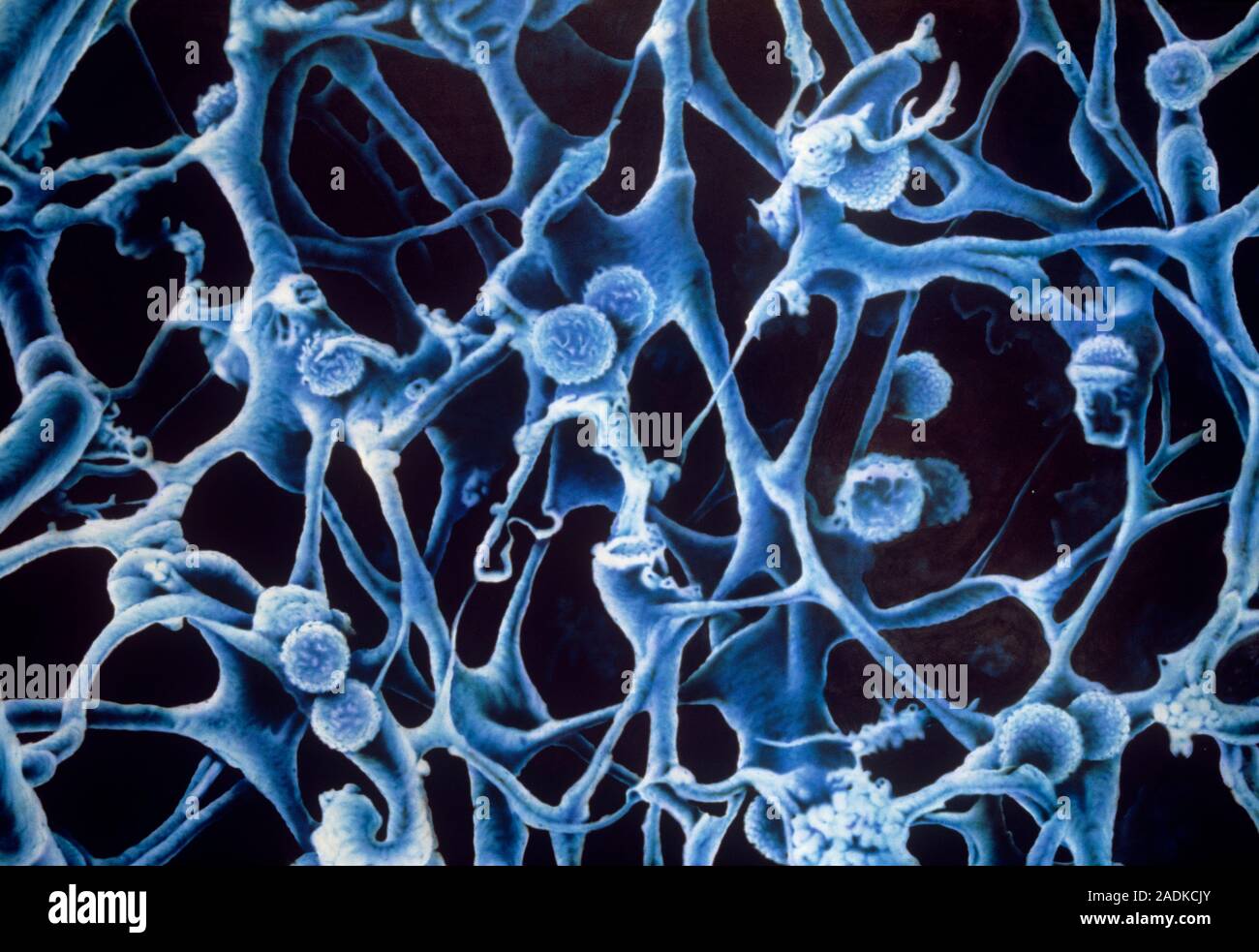 Illustration based on a scanning electron micrograph of a sectioned ...