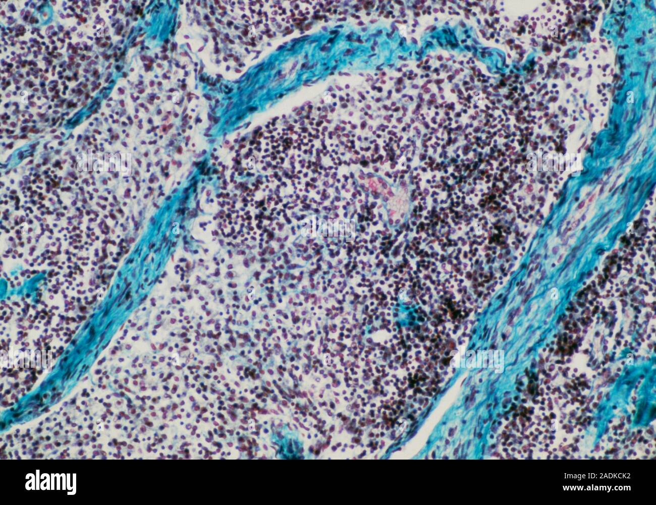 Light micrograph of a section of normal human lymph node. Each lymph ...
