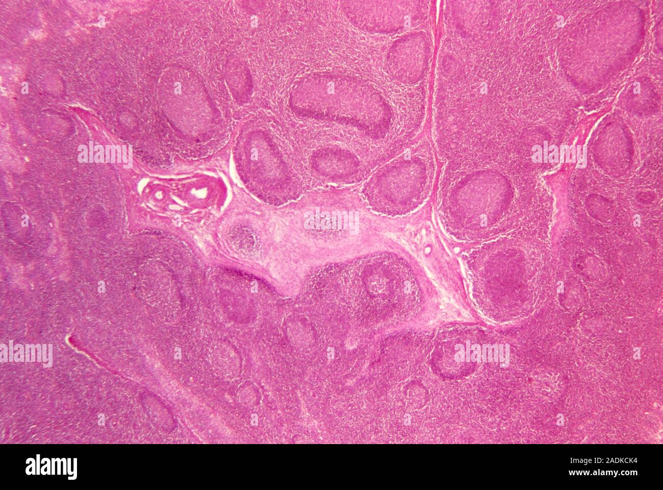 Lymph node. Light micrograph of a human lymph node. Lymph nodes are ...