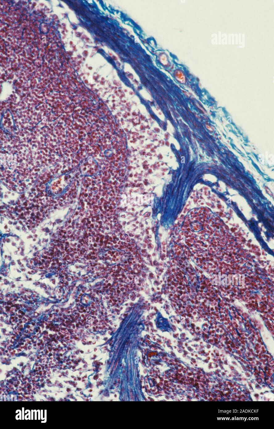 Lymph node. Light micrograph of a section through the outer part of a ...