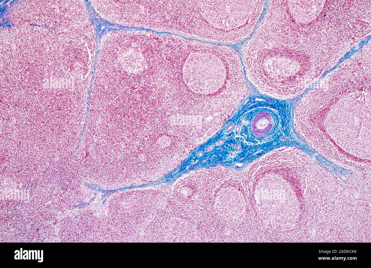 Lymph node. Light micrograph of a section through a lymph node, a ...