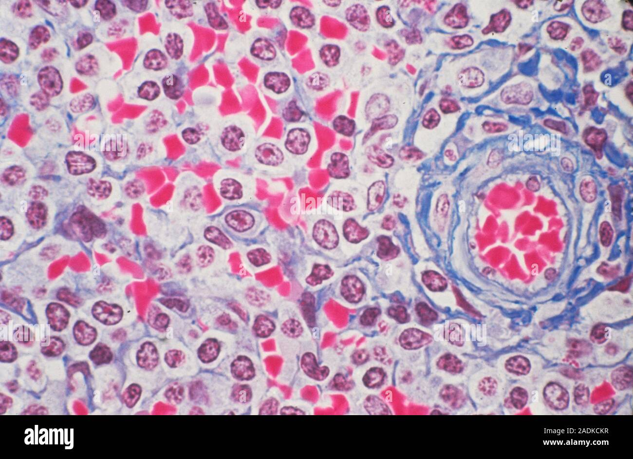 Lymph tissue. Light micrograph of a section through lymphatic tissue ...