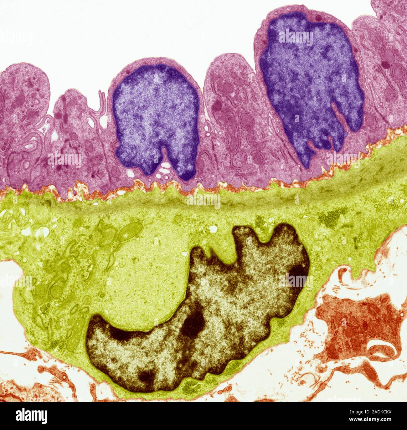 High endothelial venule. Coloured transmission electron micrograph (TEM ...