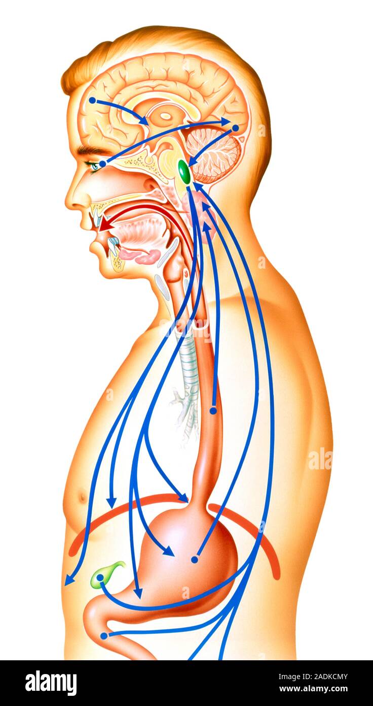 Vomiting. Illustration of the mechanism that causes vomiting in the ...
