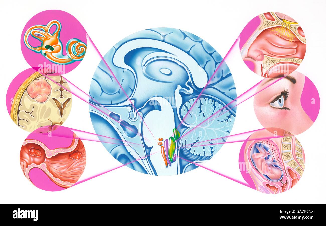 Brain nausea reflex. Artwork of the location in the brain of the area ...