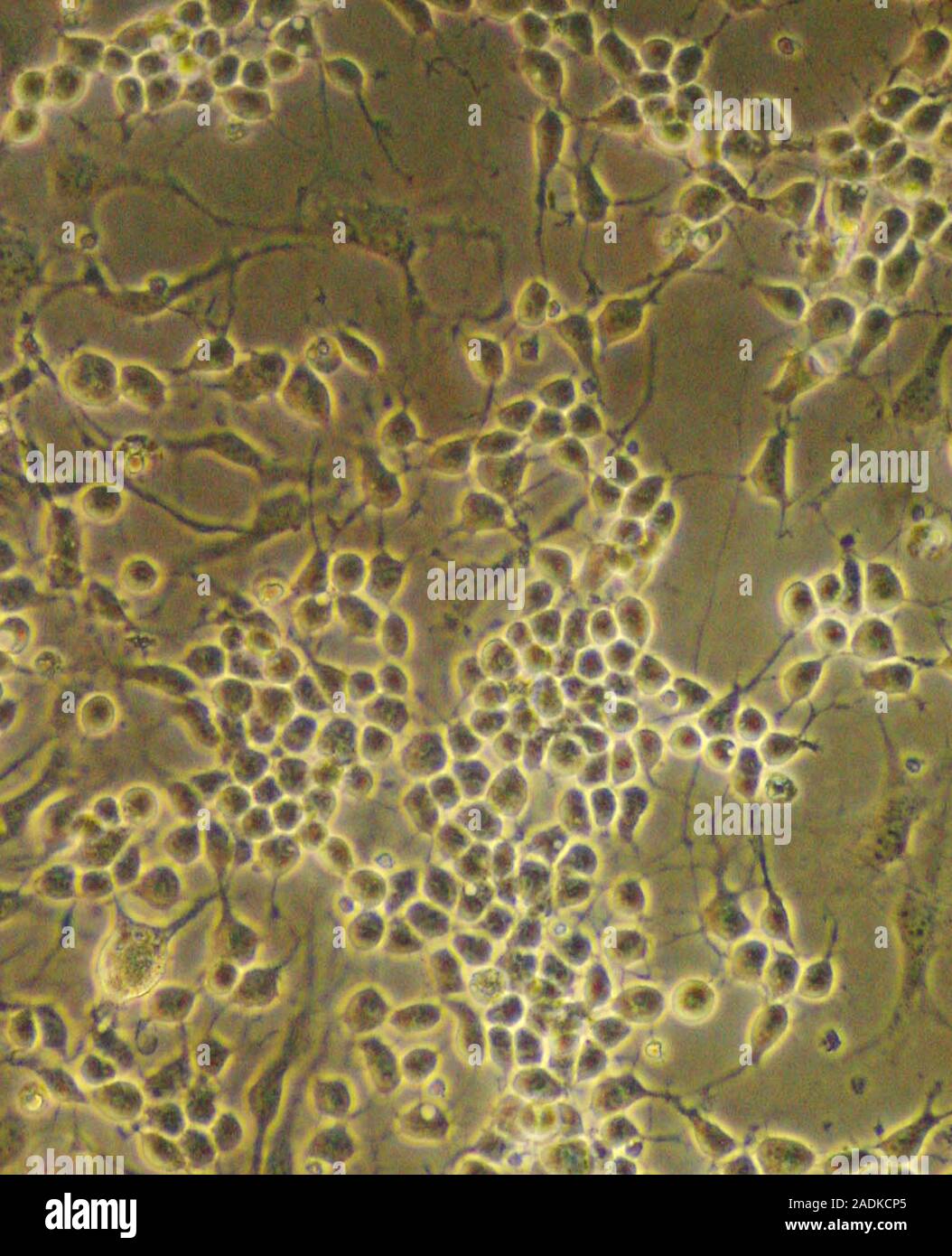 Neural stem cells. Light micrograph of self- renewing neural stem cells ...
