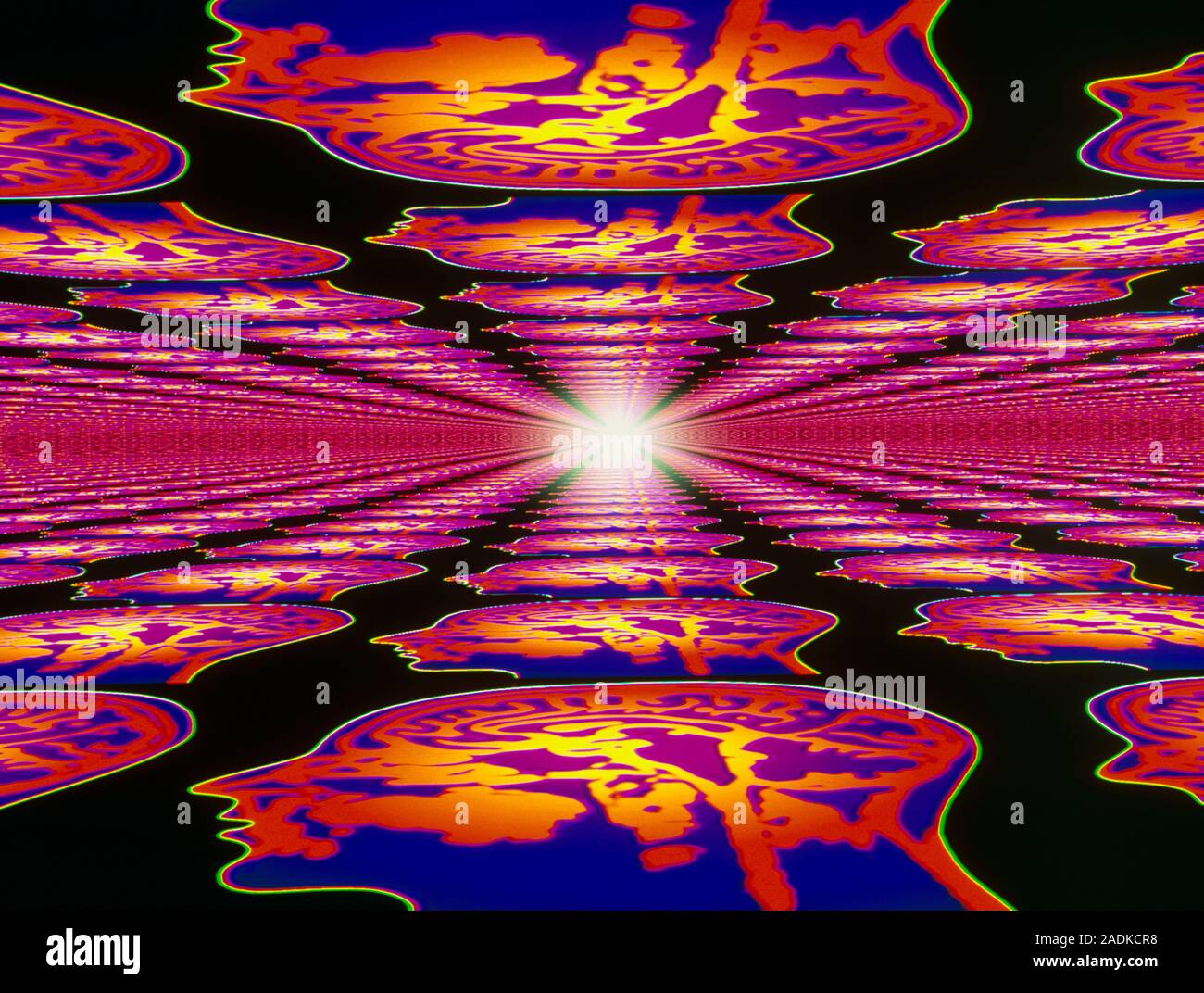 Brain scan abstract. Coloured Magnetic Resonance Imaging (MRI) scans ...