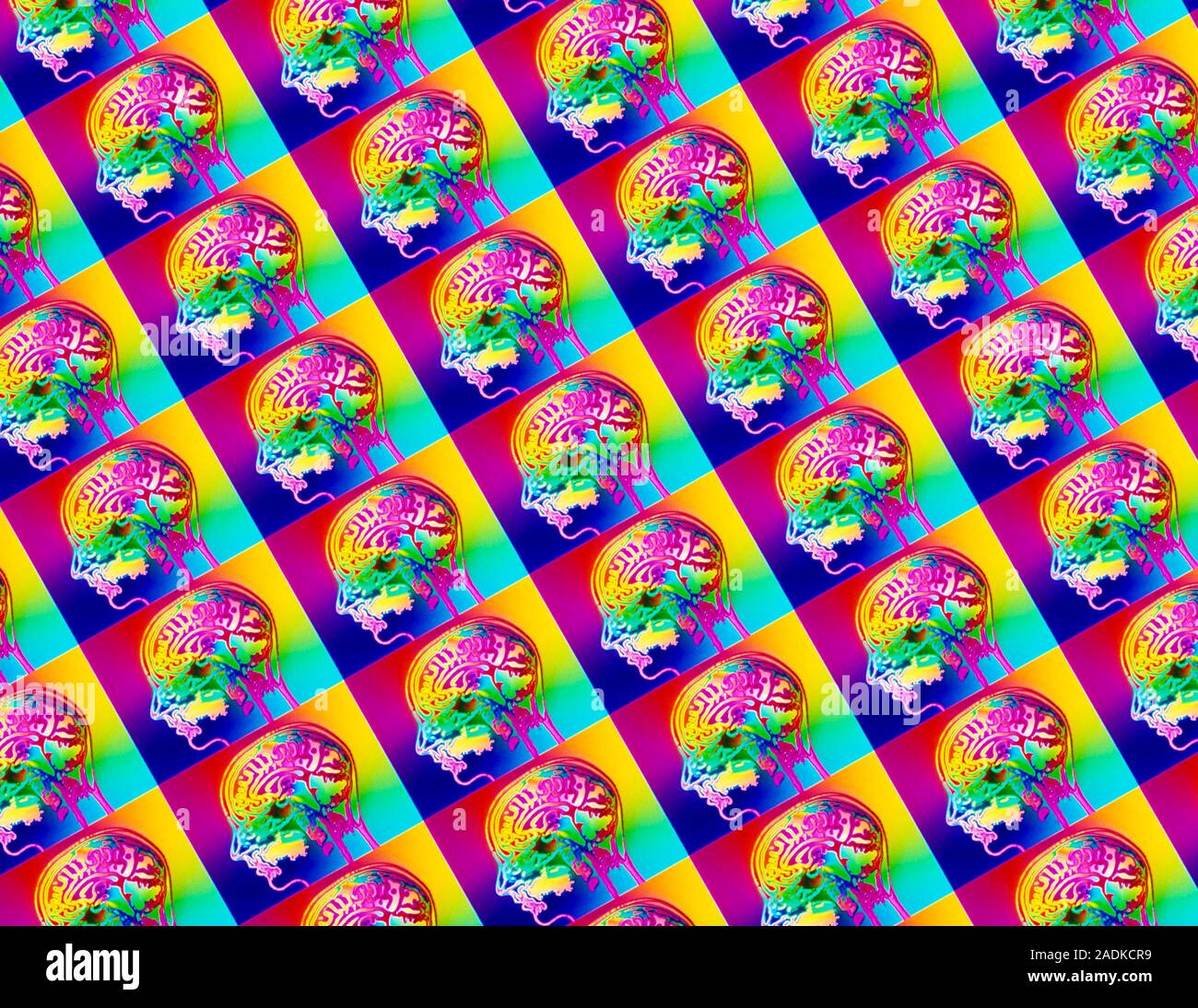 Brain scan abstract. Mosaic of multiple images of coloured Magnetic ...
