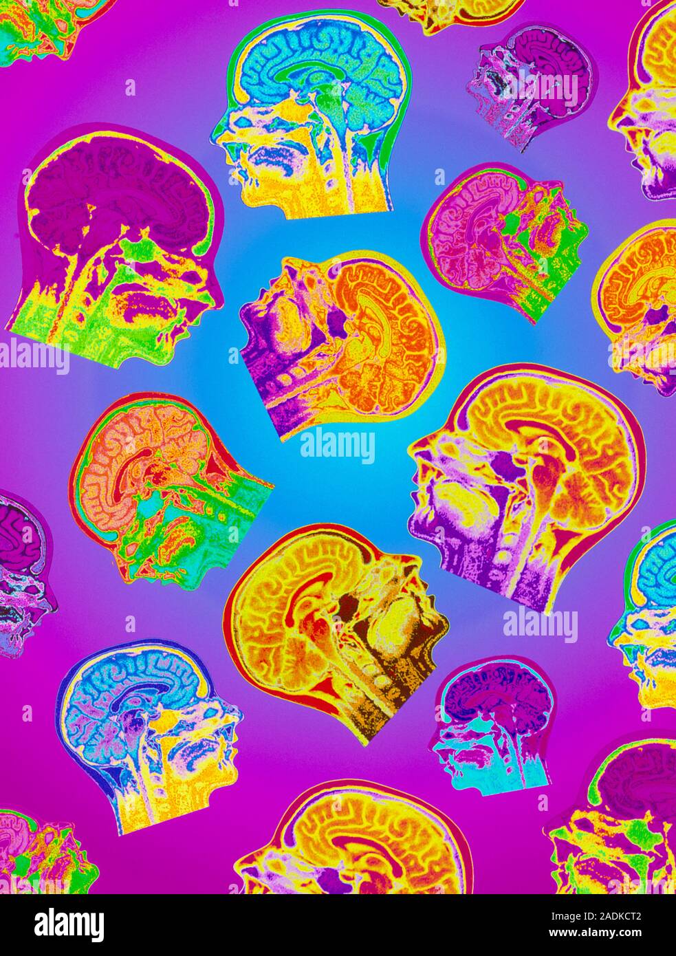 Brain scan abstract. Multiple coloured magnetic resonance imaging (MRI ...