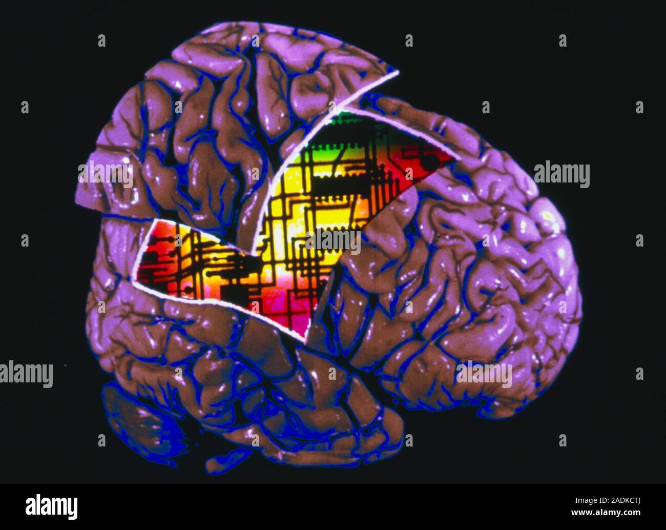 Brain circuitry. Abstract image of a coloured three-dimensional magnetic resonance imaging (MRI ...