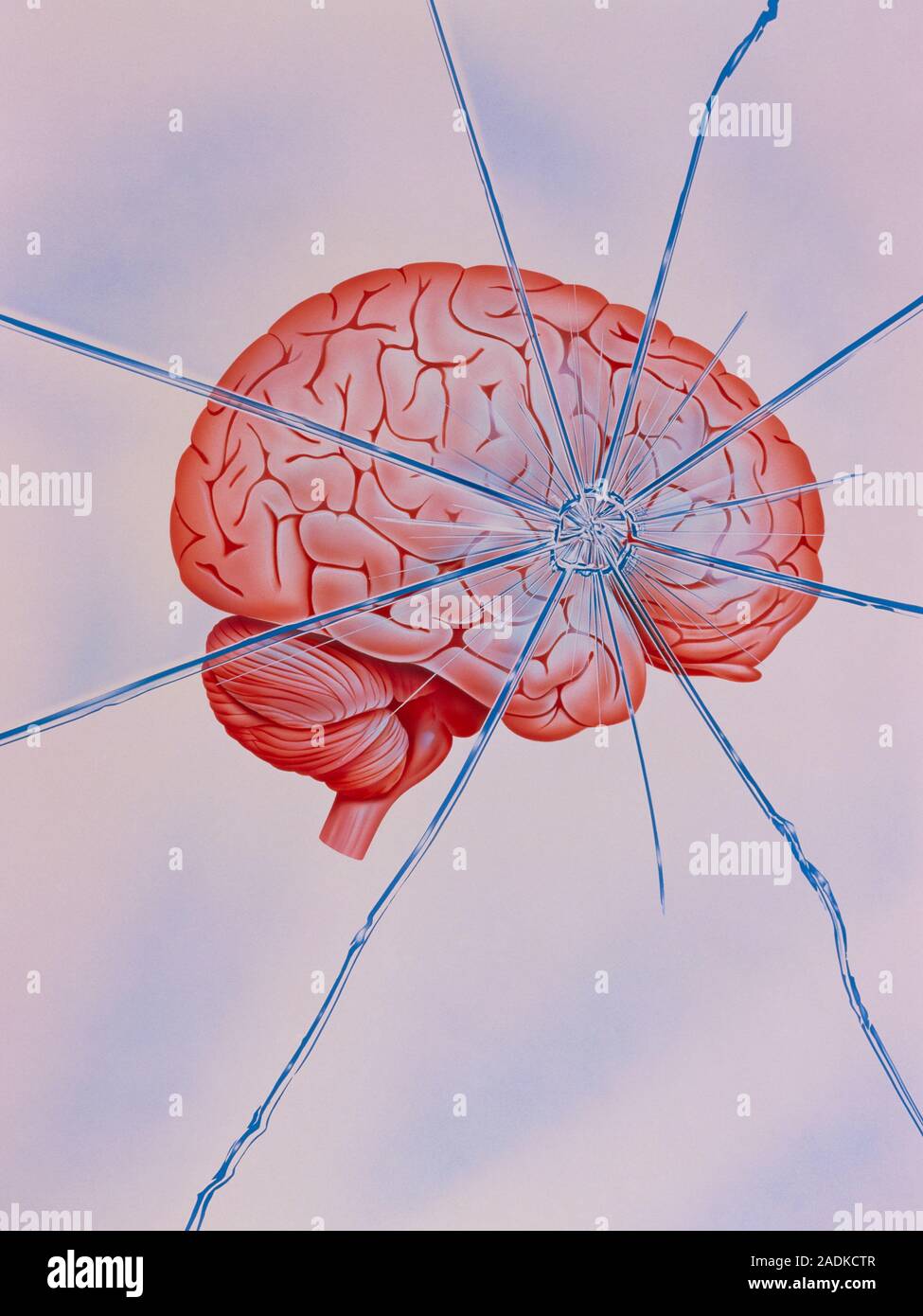 Brain with shattered glass. Illustration of a human brain with ...
