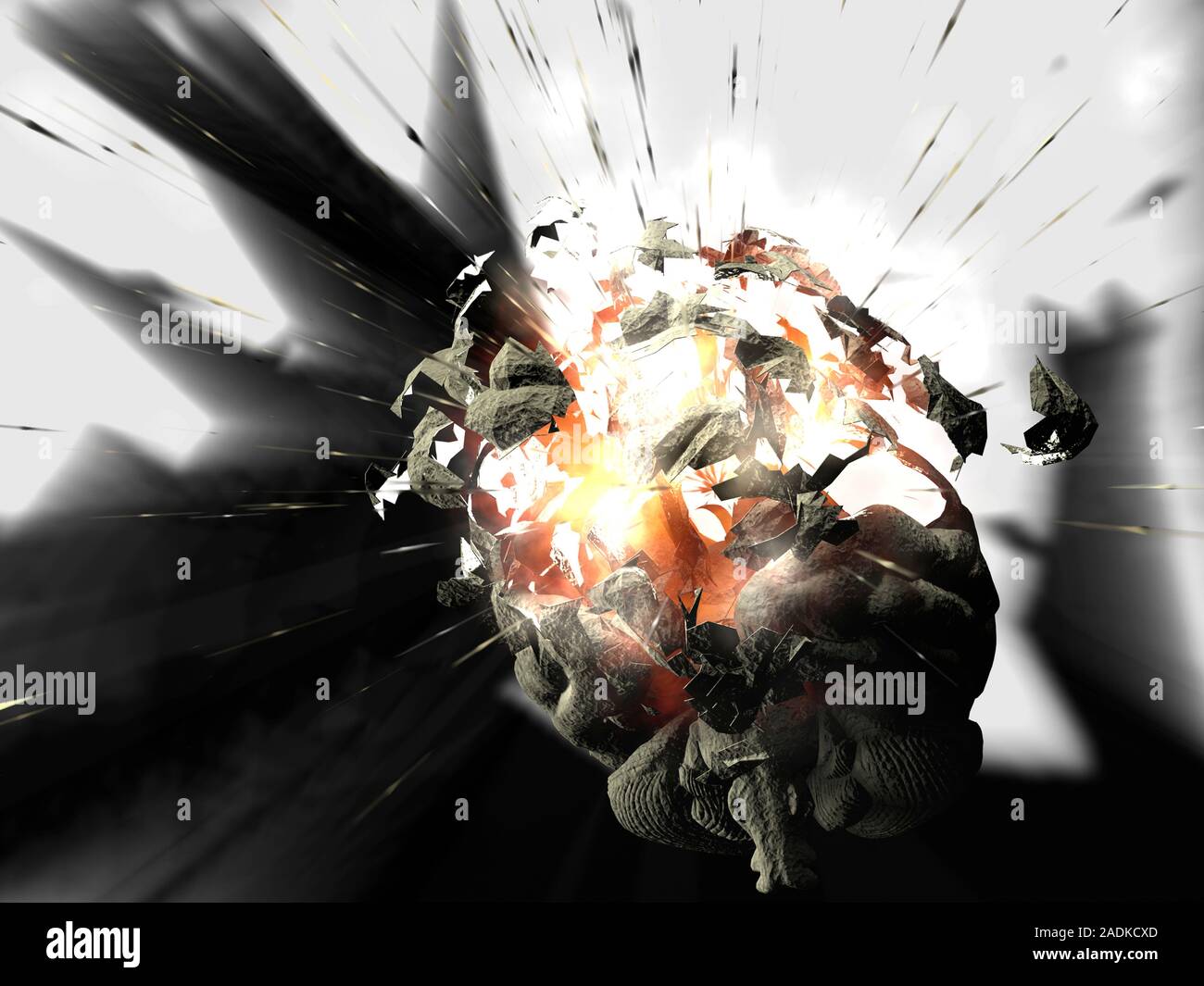 Exploding brain. Conceptual computer artwork of a human brain exploding ...