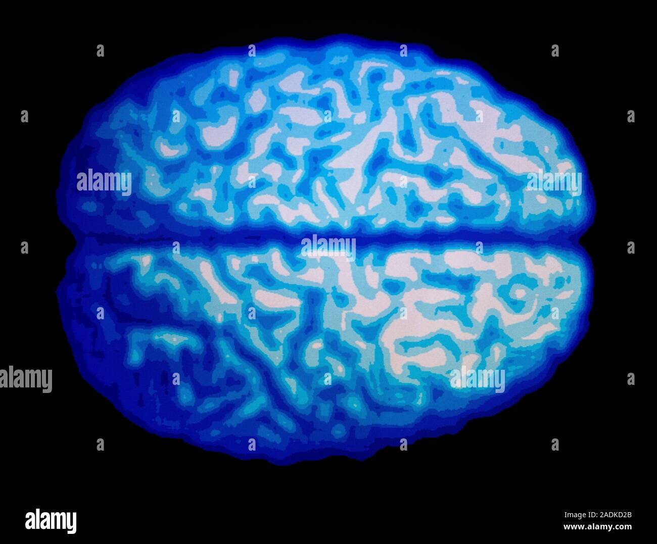Computer-generated graphic of a superior view of the human brain Stock ...