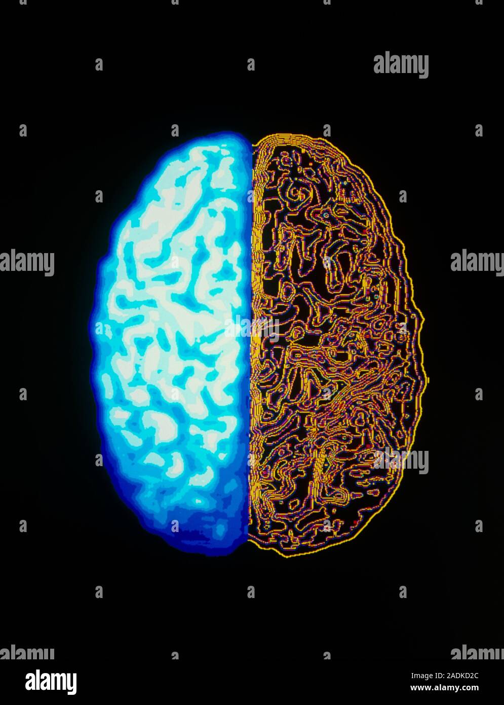 Computer-generated graphic of a superior view of the human brain. One ...