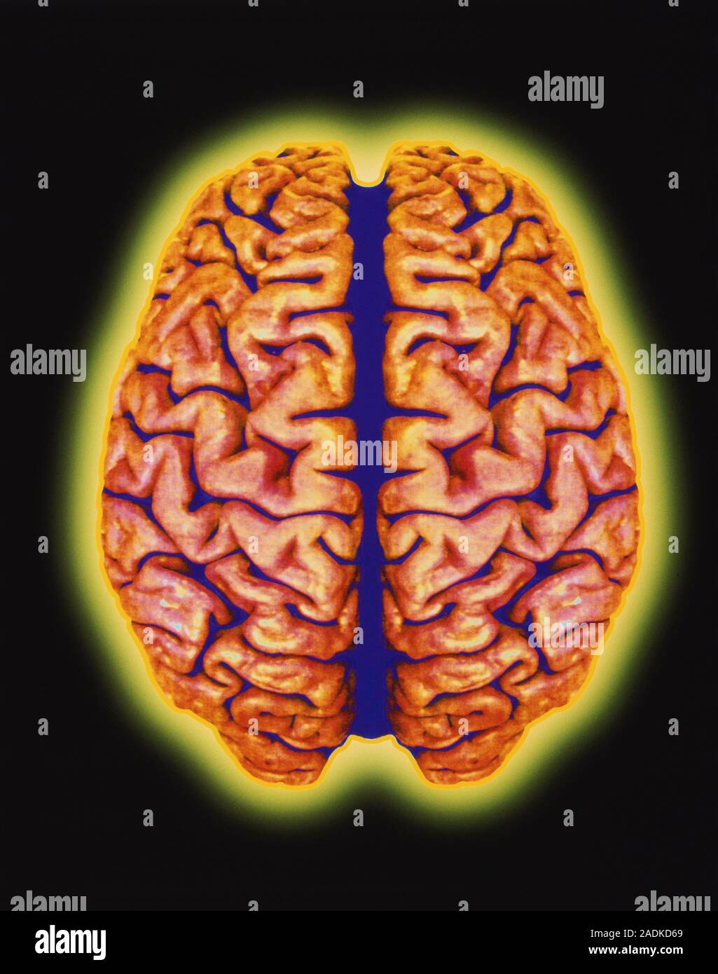 Human brain. Computer artwork of the human brain, seen in top view ...