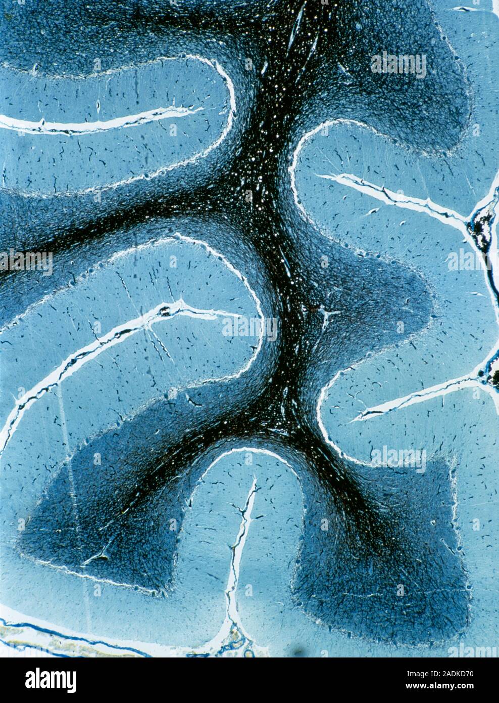 Cerebellum. Light micrograph of a cross-section through the cortex ...
