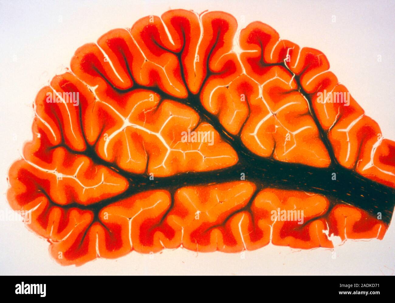 Cerebellum. Light micrograph of a cross-section through the cortex ...