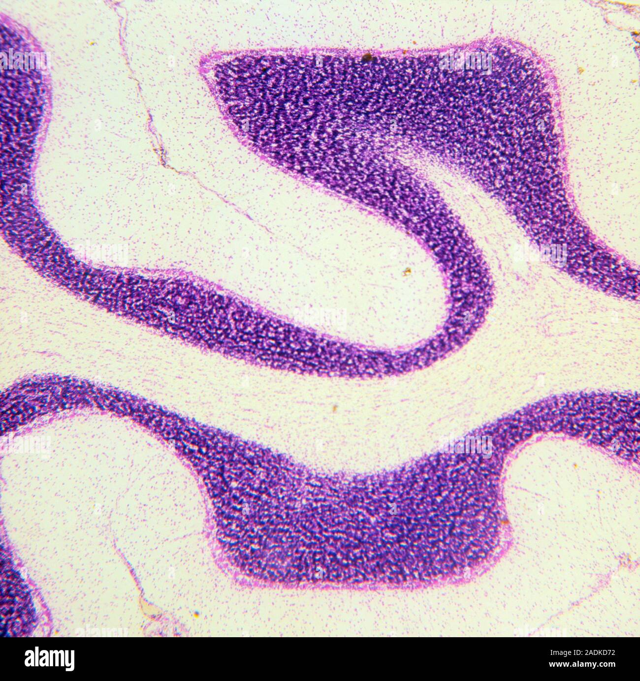 Cerebrum. Light micrograph of a section through the cerebrum of a human ...