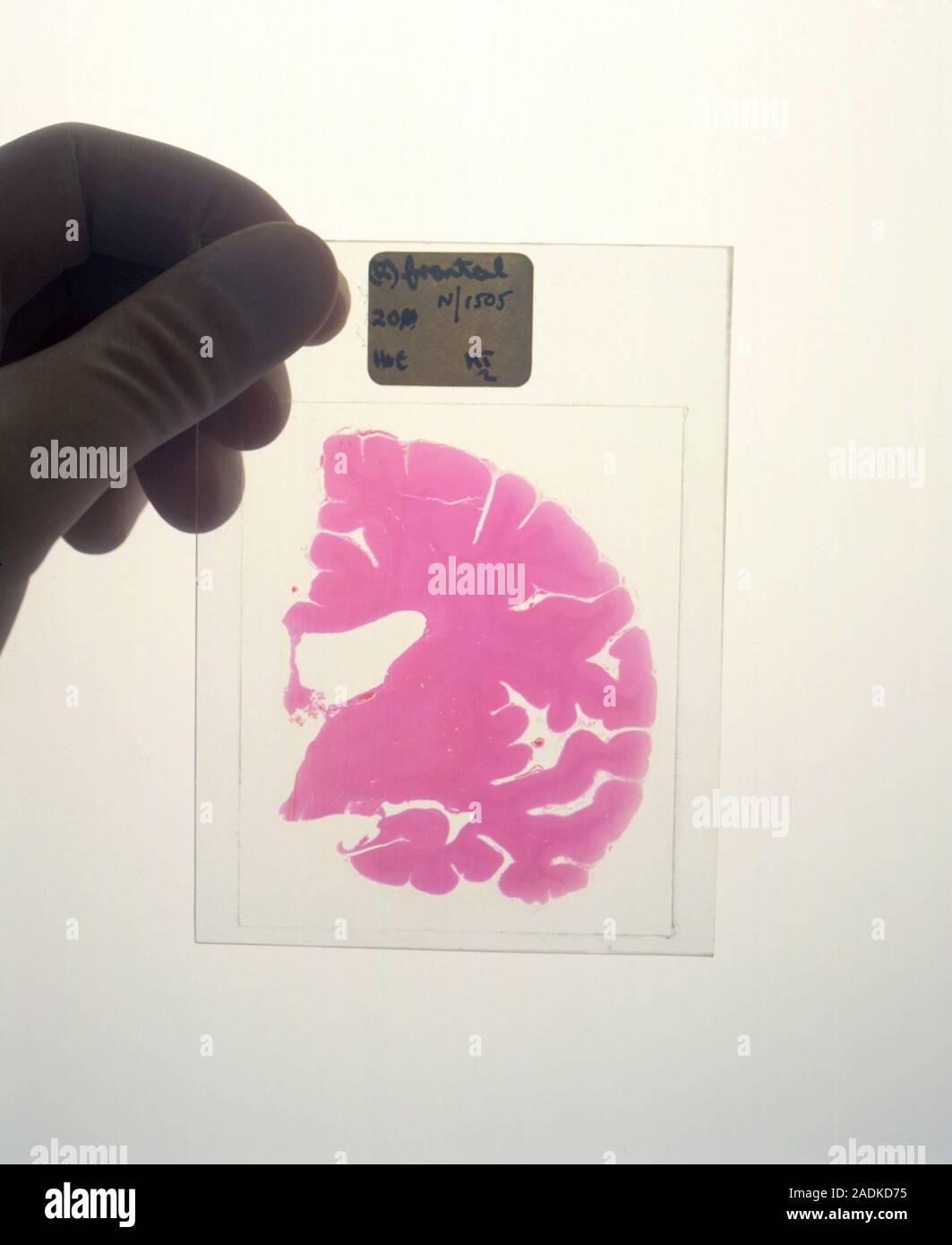 Brain slice. Gloved hand holding up a microscope slide of a section ...