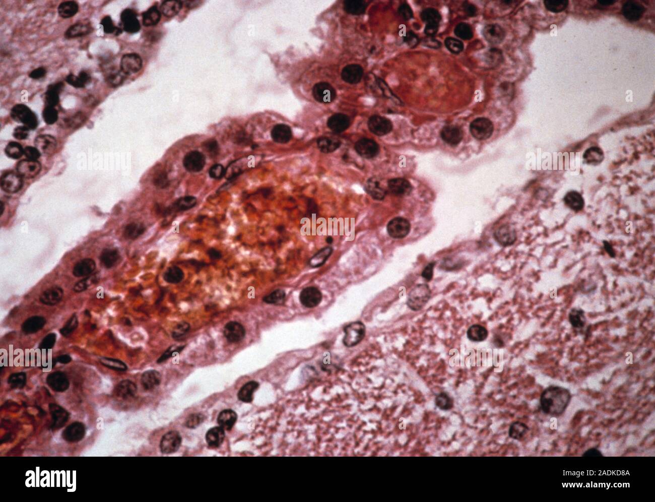 Choroid plexus in brain. Light micrograph of a section through the ...