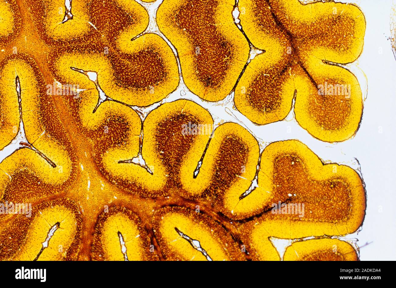 Brain tissue. Light micrograph of a section through the cerebellum of ...