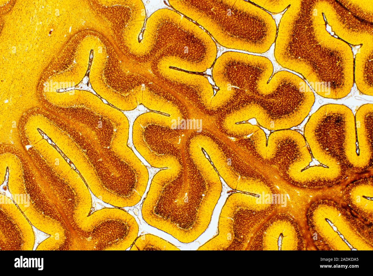 Brain tissue. Light micrograph of a section through the cerebellum of ...